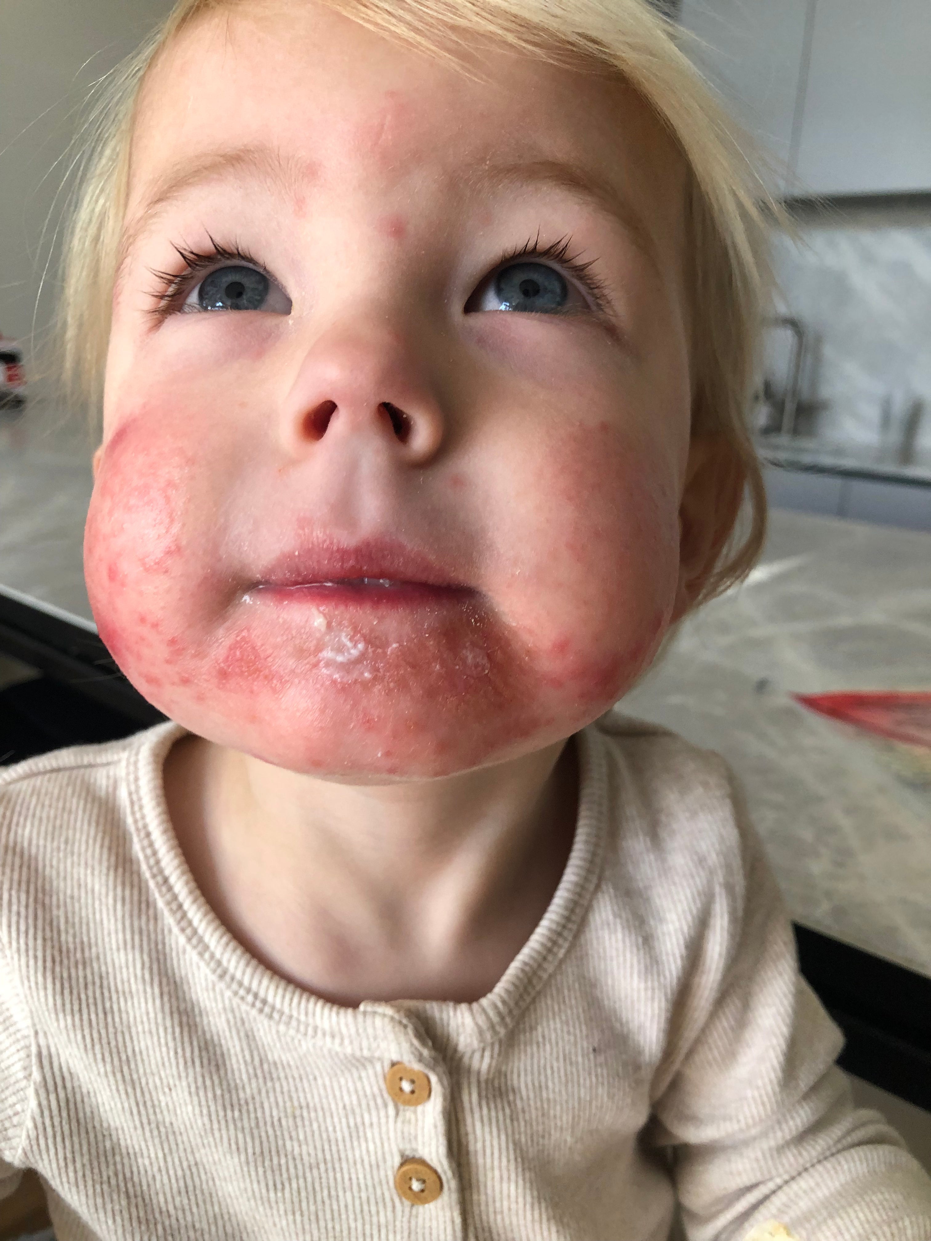 Top 10 Most Common Skin Conditions (And How to Spot Them Early) – Treemu